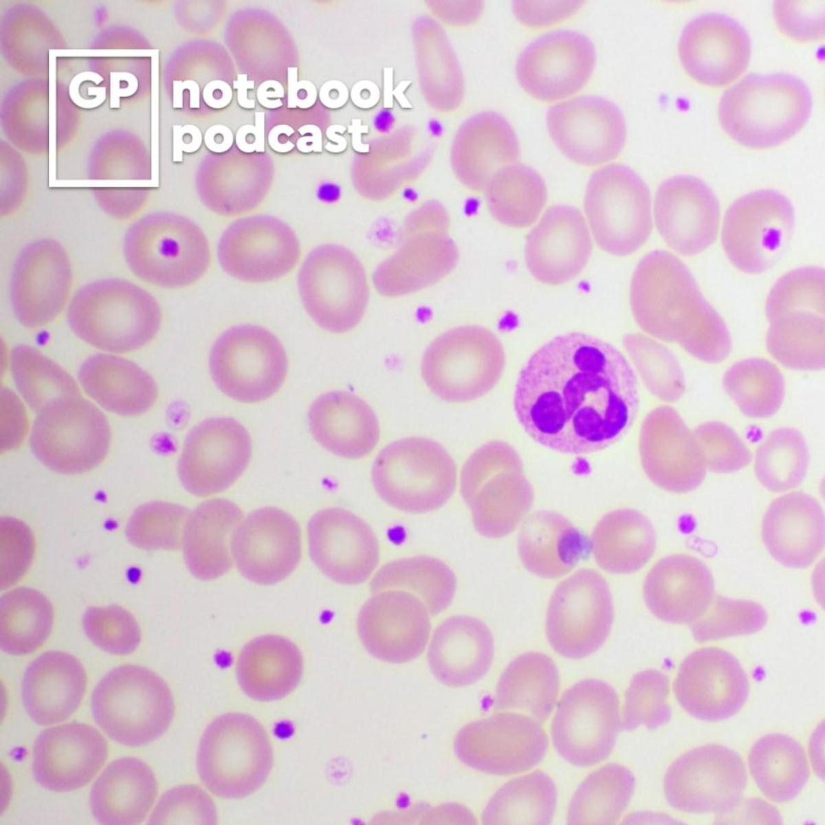 Ep 21 - Managing unexplained high platelet counts in primary care