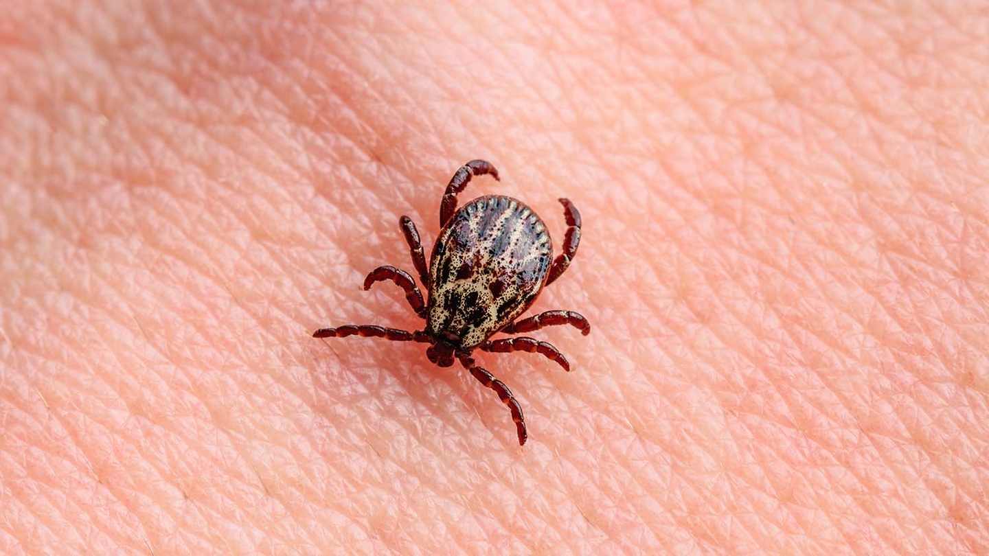 Lyme Disease Gpnotebook 7930