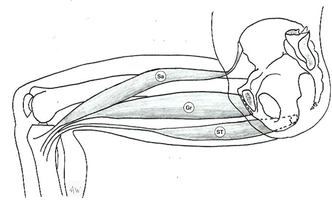 Injection or aspiration of pes anserine bursa – GPnotebook