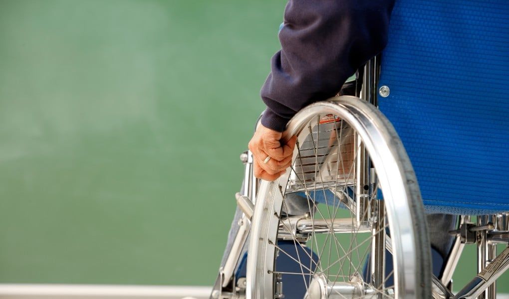 Epidural Hematoma: Delayed Treatment Results in Paraplegia