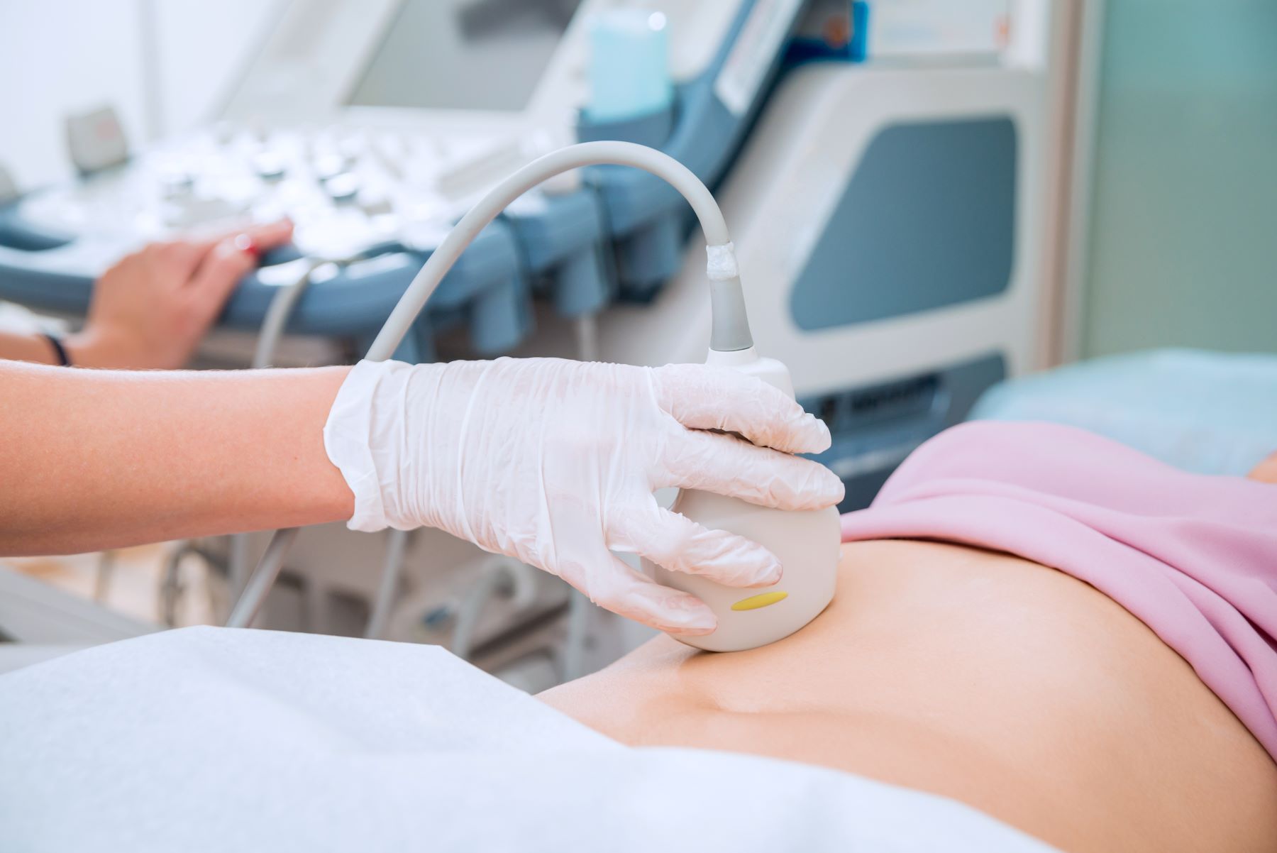 Acute Appendicitis in Pregnancy | Guide for Attorneys
