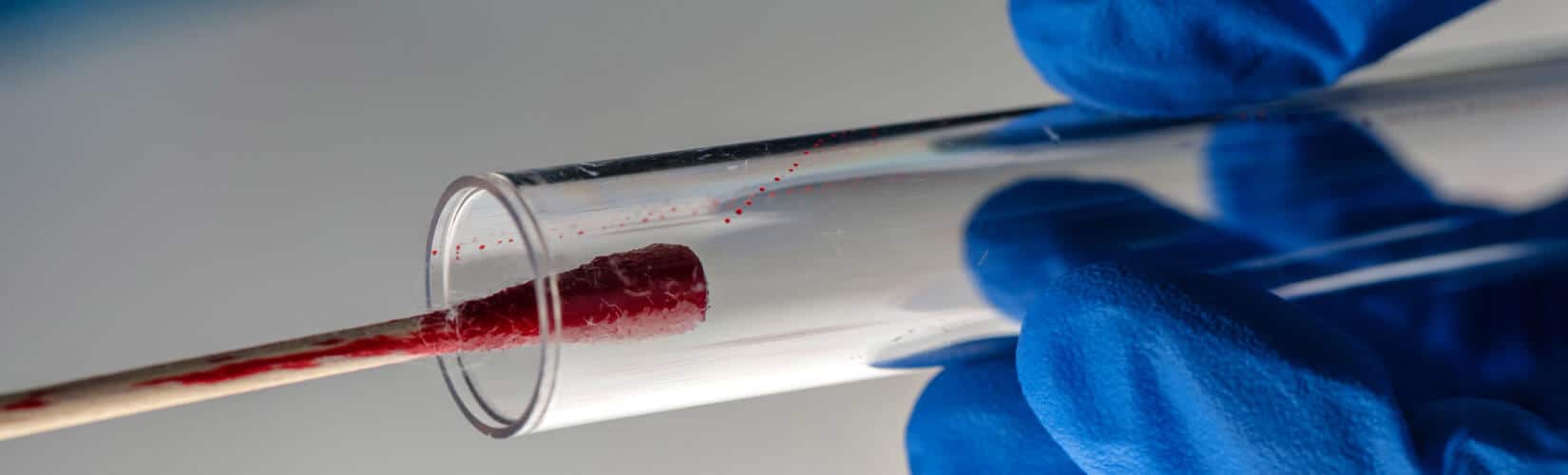 The Staircase: Netflix Documentary Calls Unreliable Forensic Science ...