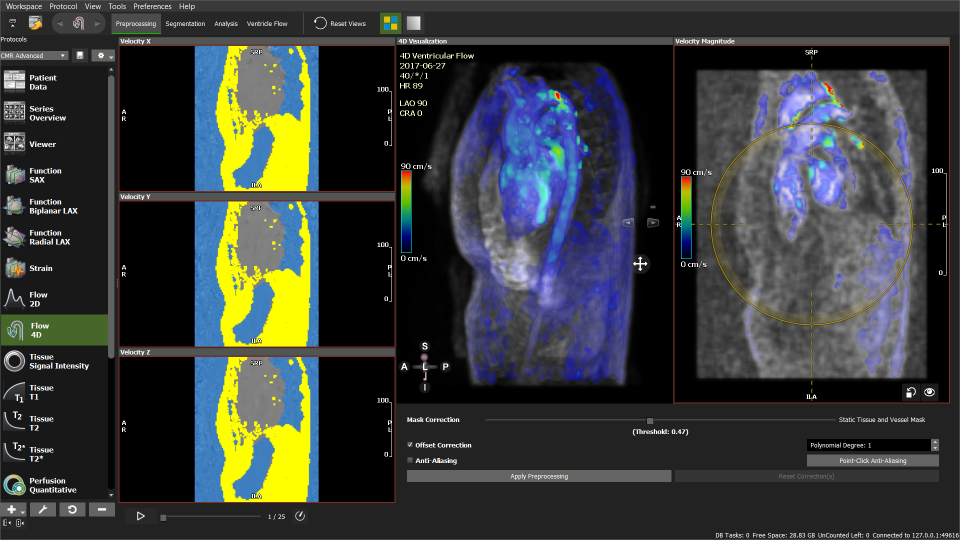 What's New | Circle Cardiovascular Imaging