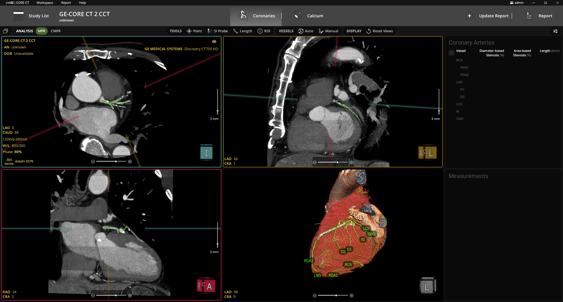 cvi42 Overview | Circle Cardiovascular Imaging