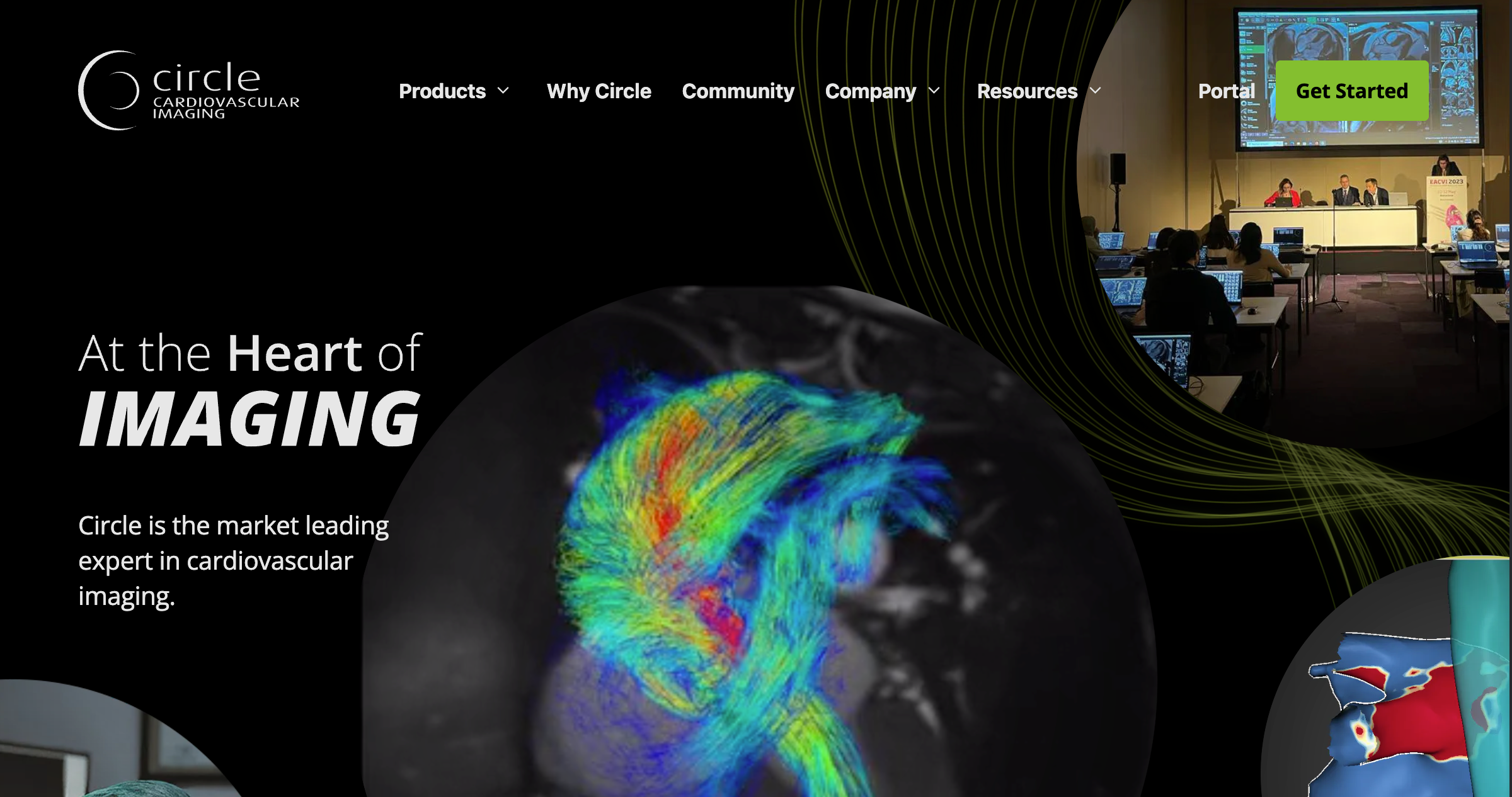 Comparing Cardiac Electrophysiology Techniques Circle Cardiovascular