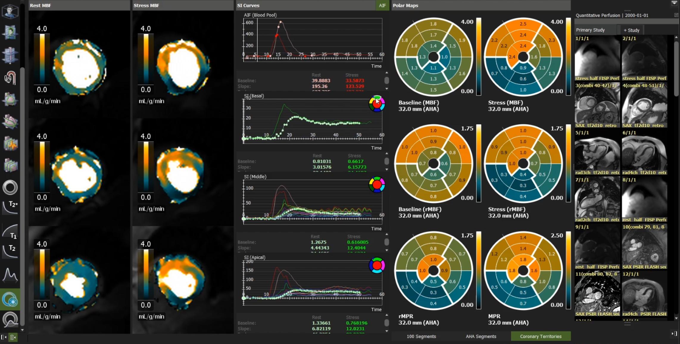 Cardiac MR | Circle Cardiovascular Imaging