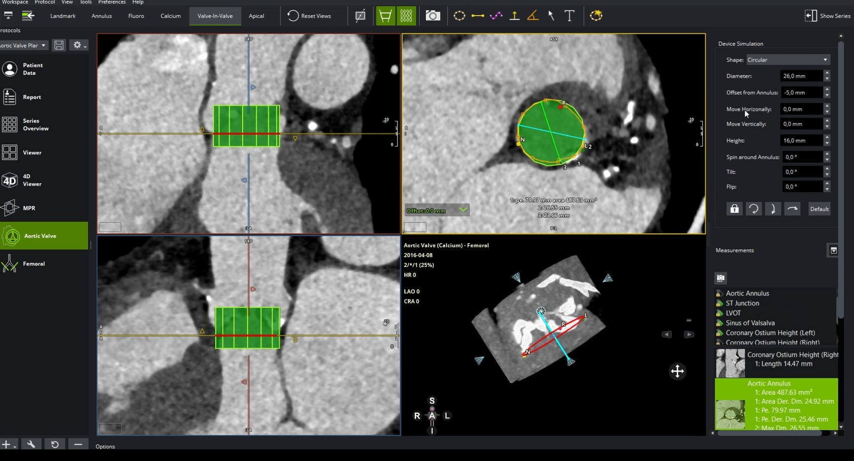 cvi42 Overview | Circle Cardiovascular Imaging