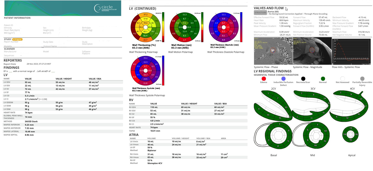 Cardiac MR | Circle Cardiovascular Imaging