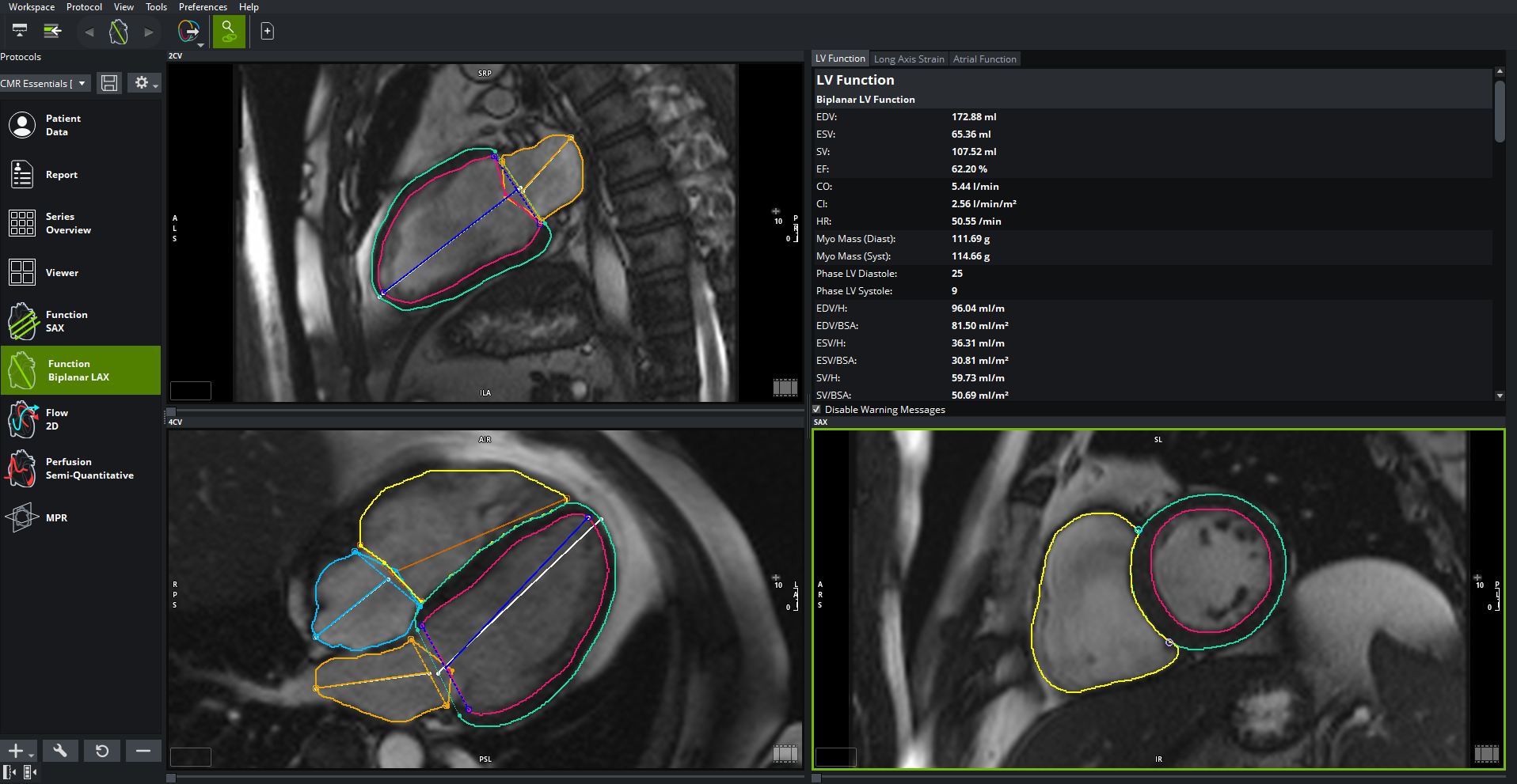 cvi42 Overview | Circle Cardiovascular Imaging