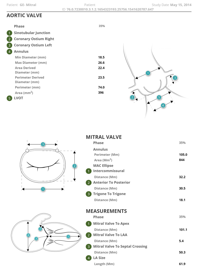 Interventional Planning | Circle Cardiovascular Imaging