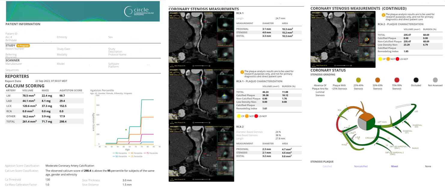 Cardiac CT | Circle Cardiovascular Imaging