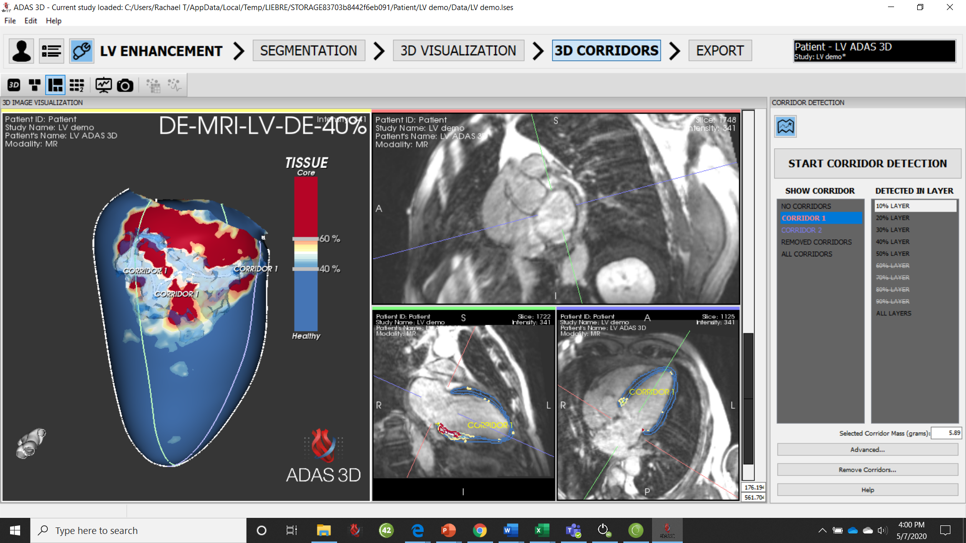 cvi42 Overview | Circle Cardiovascular Imaging