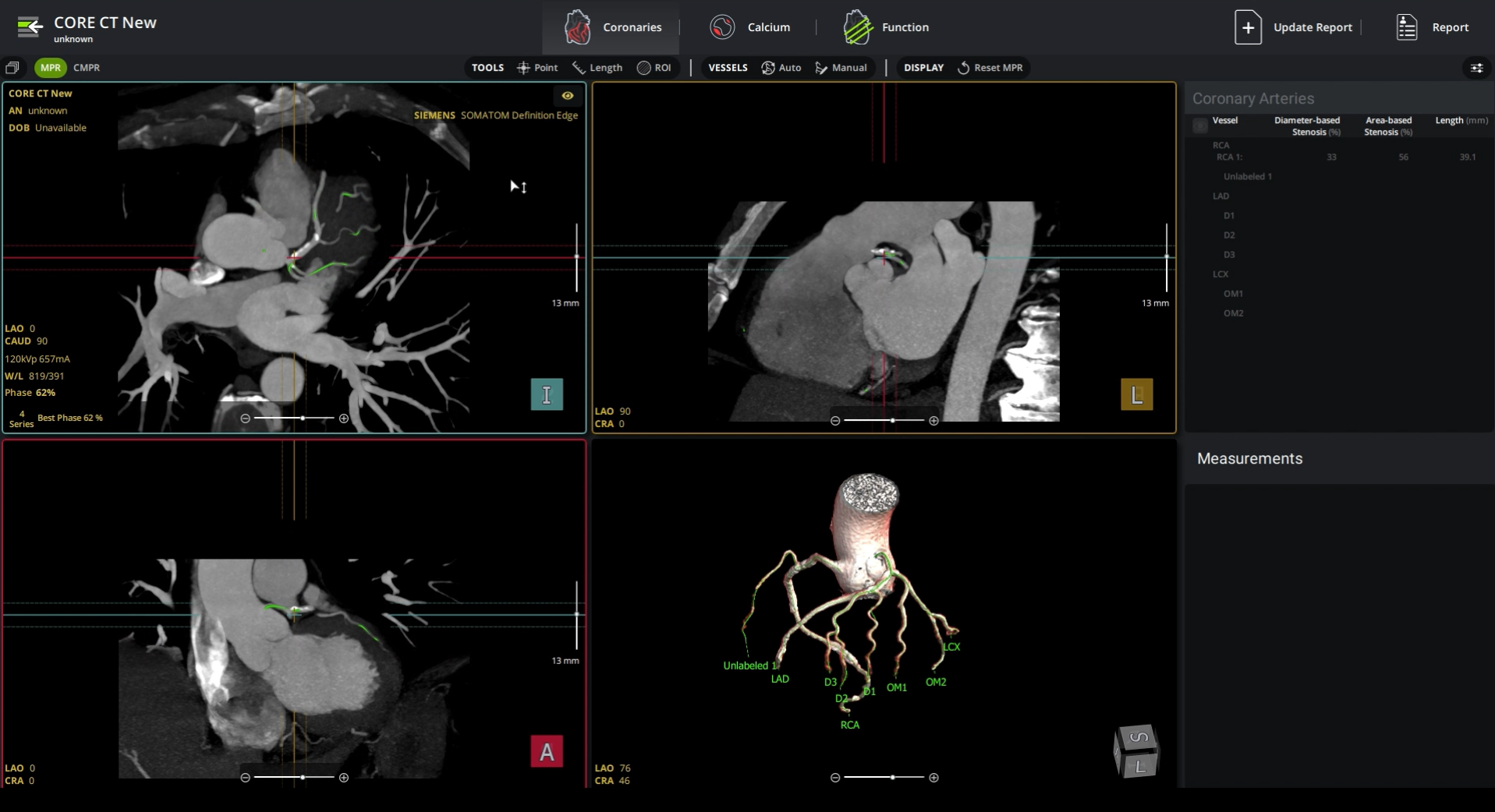 cvi42 Overview | Circle Cardiovascular Imaging