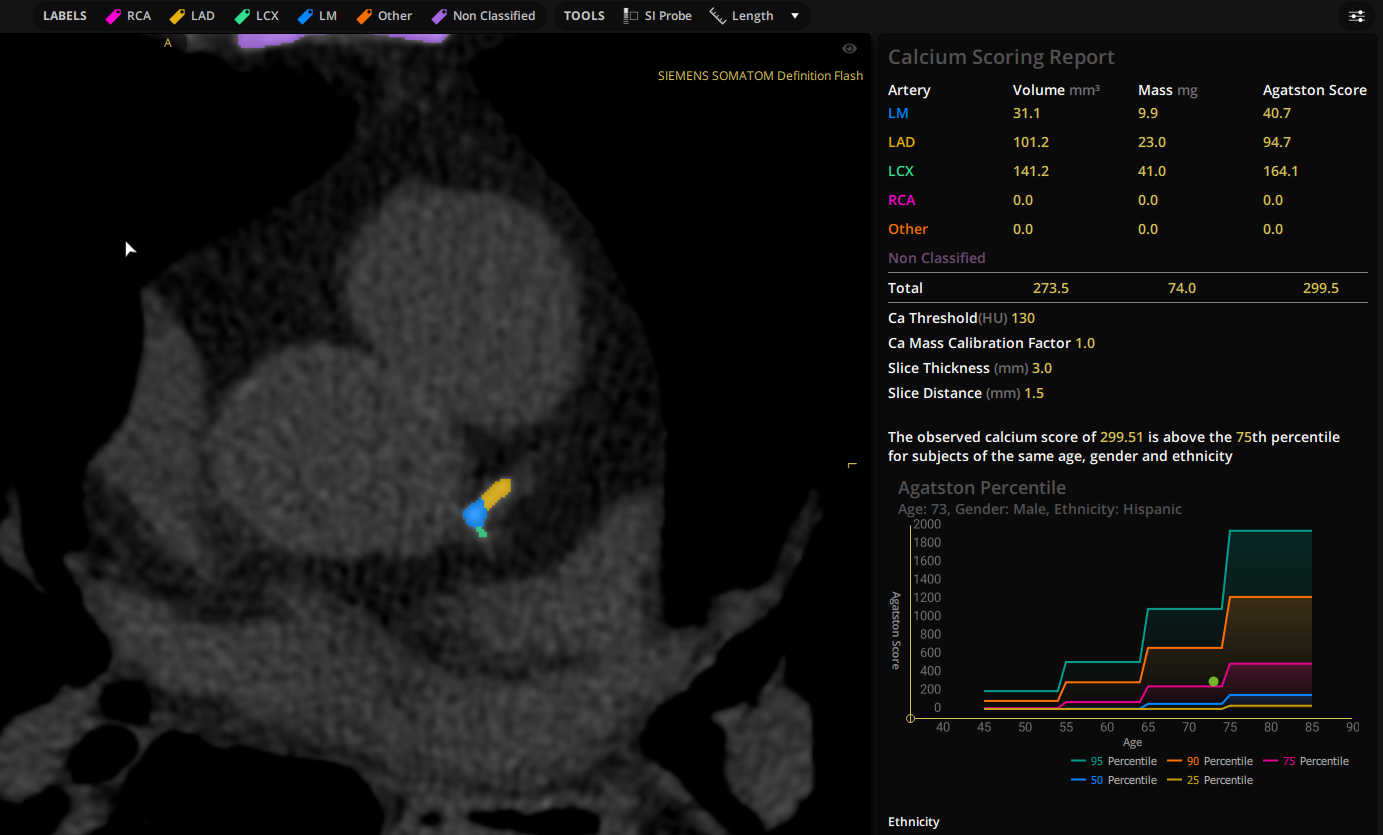 What's New | Circle Cardiovascular Imaging