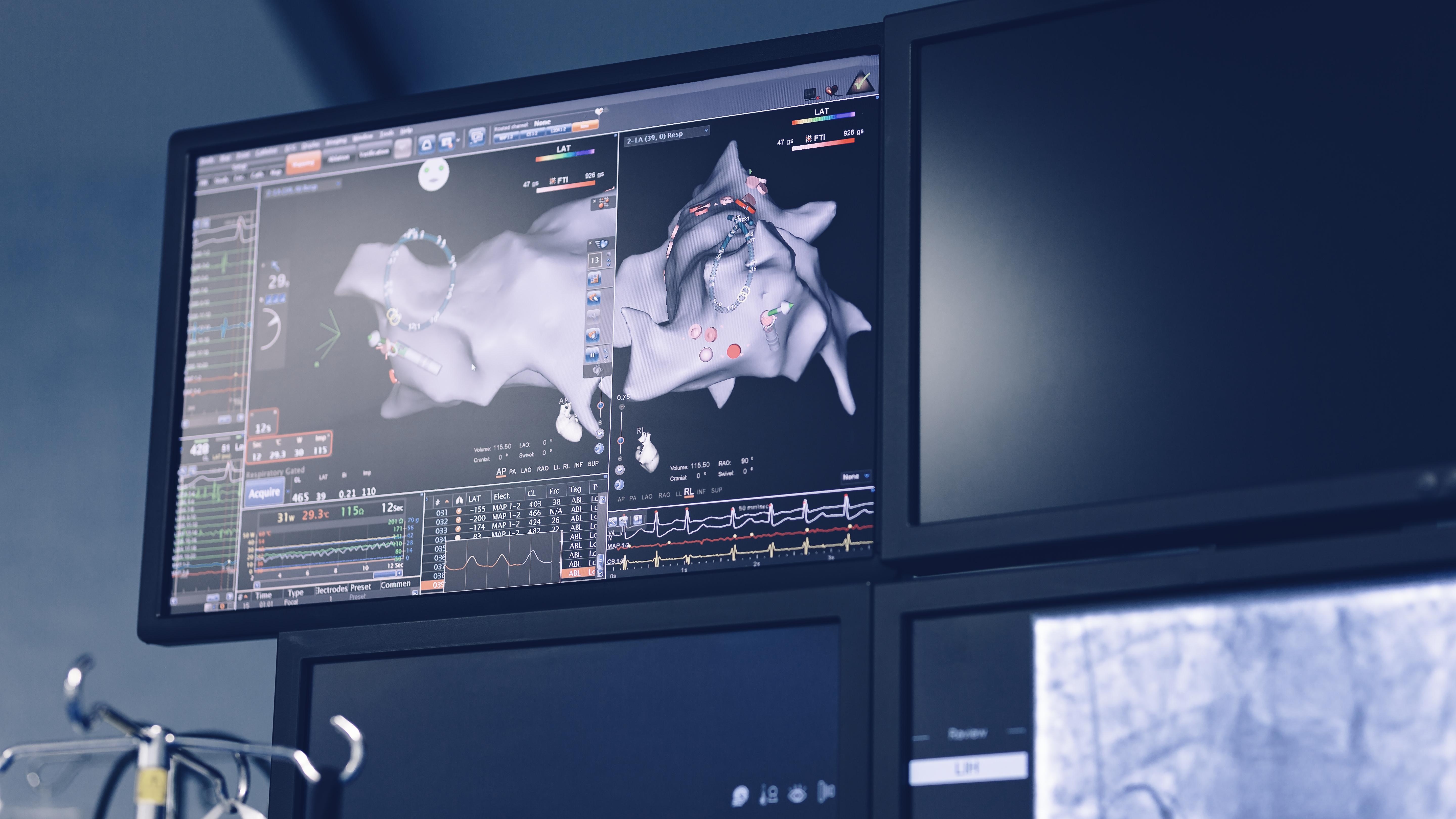 Electrophysiology | Circle Cardiovascular Imaging