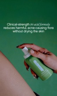 Topicals | Clearly Acne Mist
