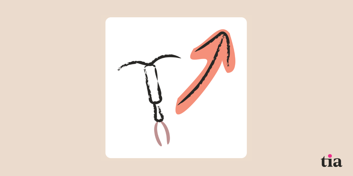 Copper IUDs: Everything You Need To Know About Non-hormonal, 58% OFF