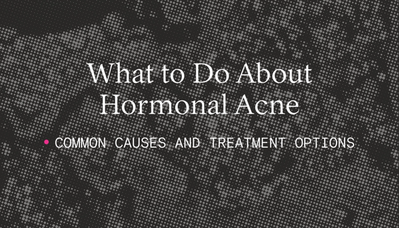 What is hormonal acne and how to treat it?