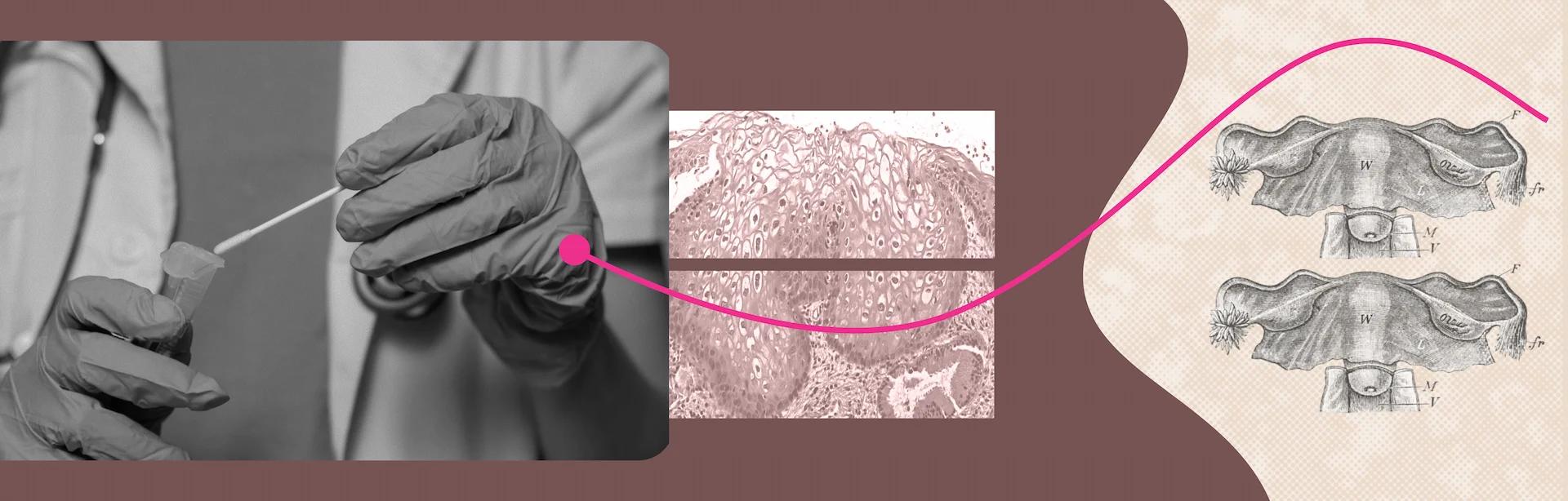 Cervical Cancer Screening Guide