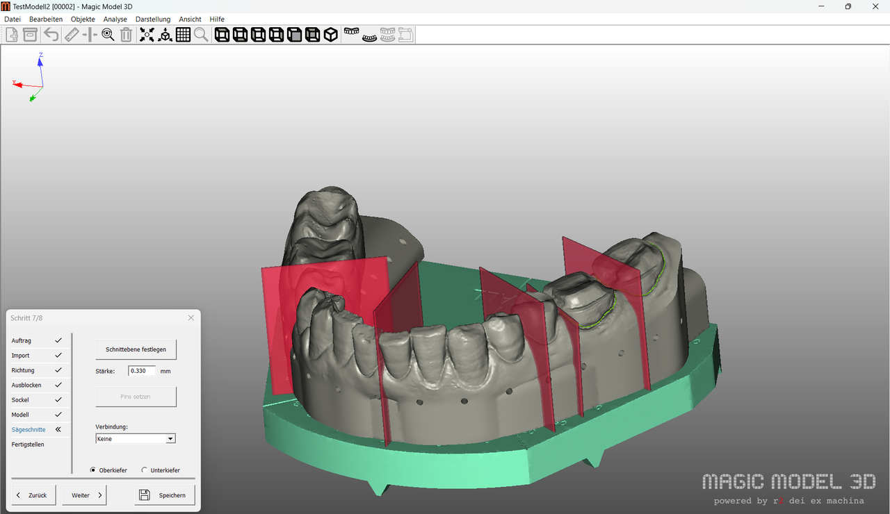 Magic | High level dental 3D printing