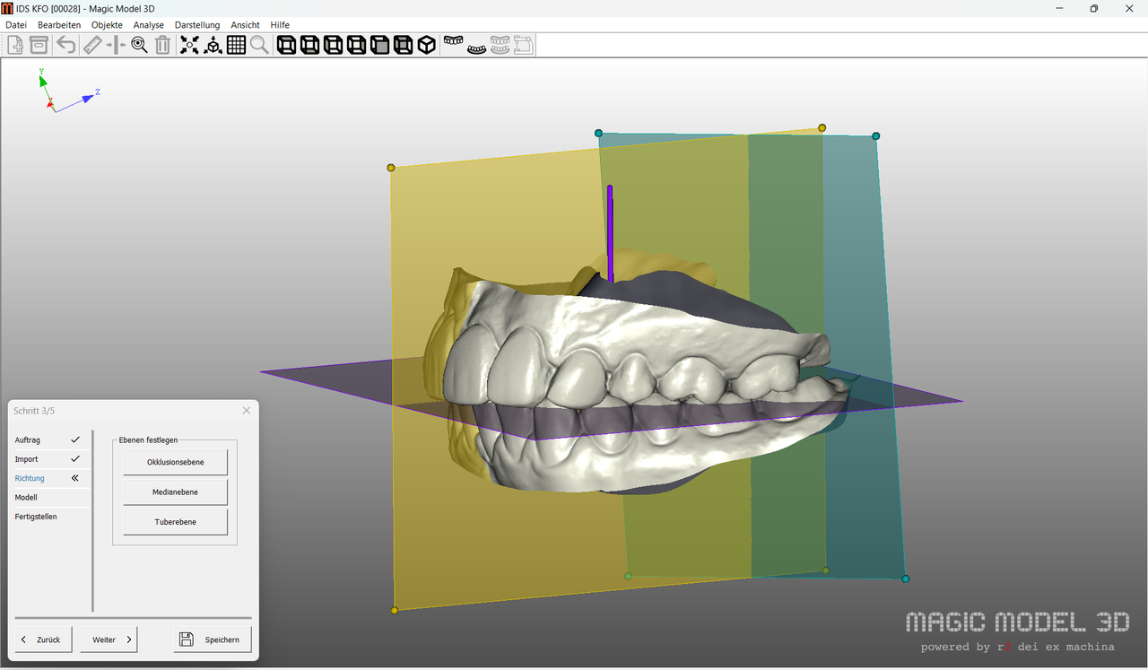 Magic | High level dental 3D printing