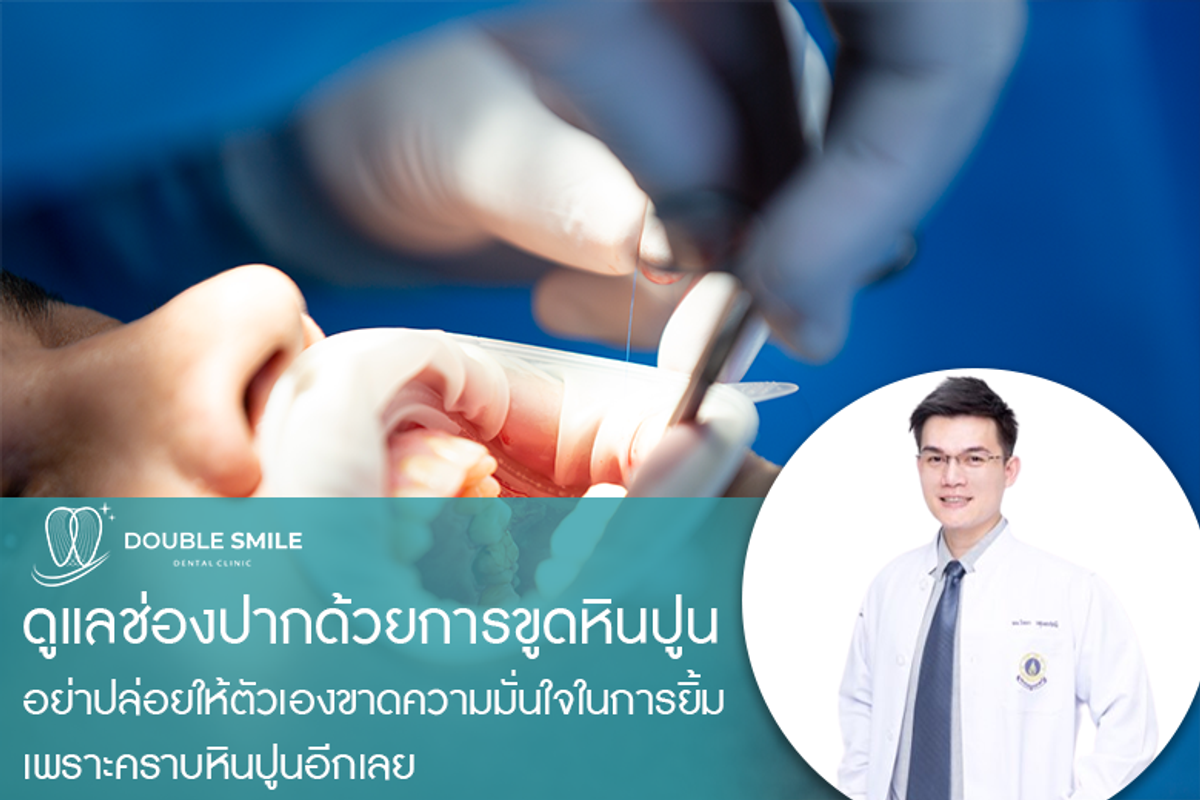 ดูแลช่องปากด้วยการขูดหินปูนกับ Double Smile Dental Clinic อย่าปล่อยให้ ...