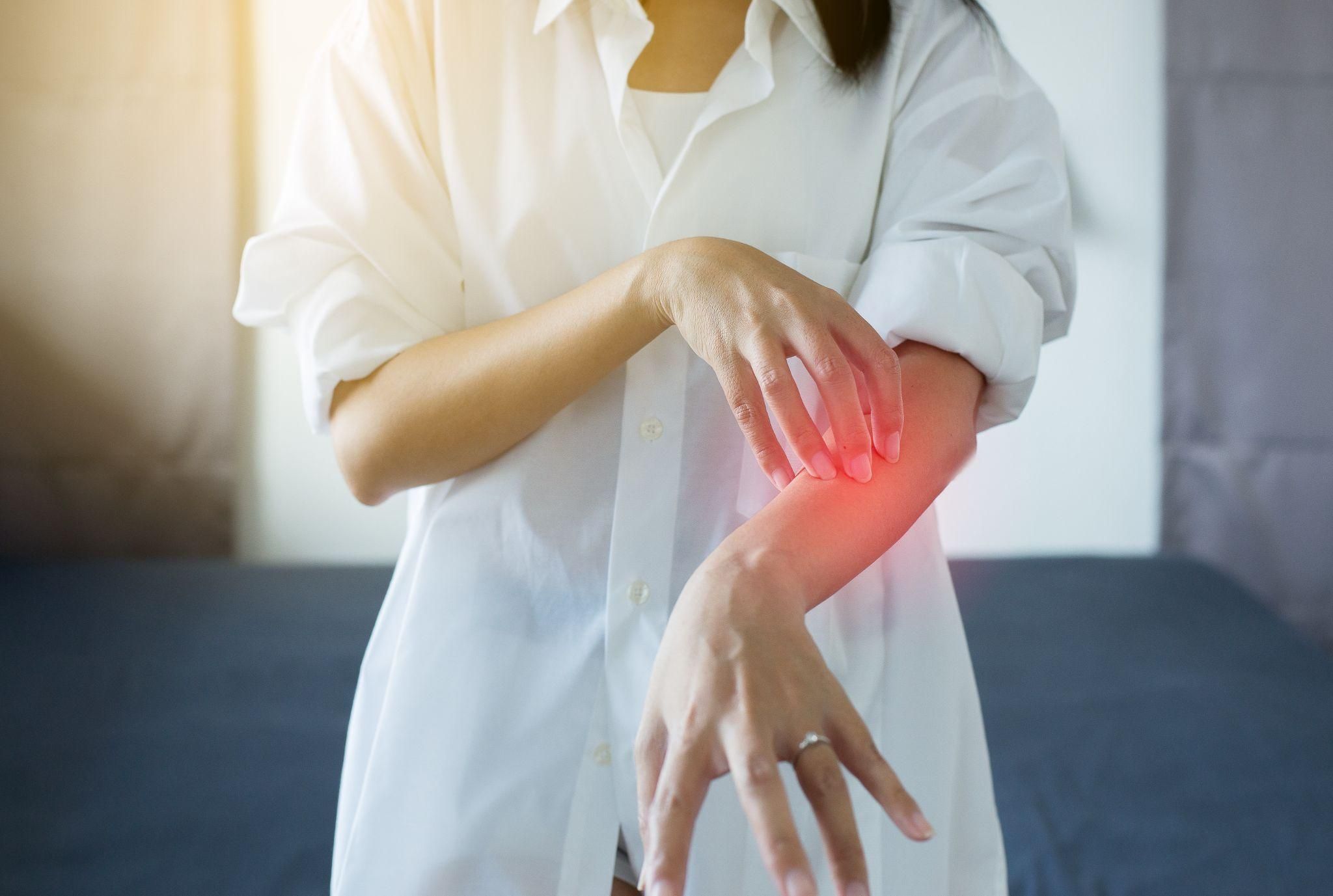 What Is Heat Rash? Causes, Symptoms, and How to Treat It - 24hrdoc