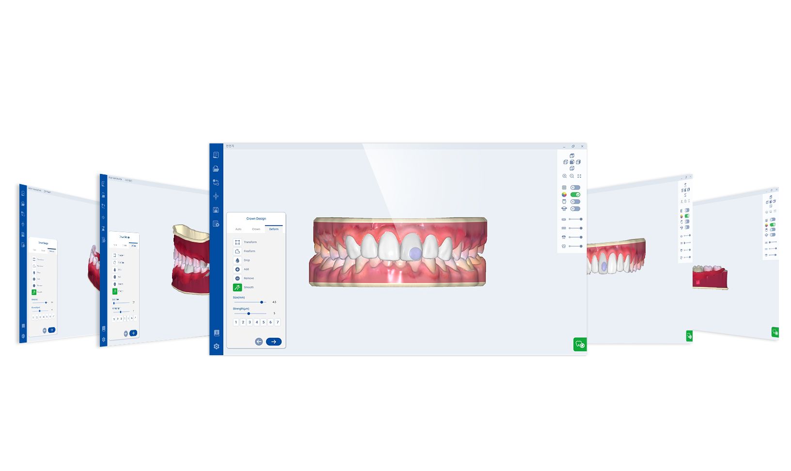 RAY - The Future of Face-Driven Dentistry