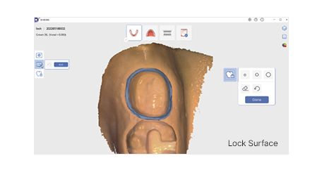 RAY - The Future of Face-Driven Dentistry