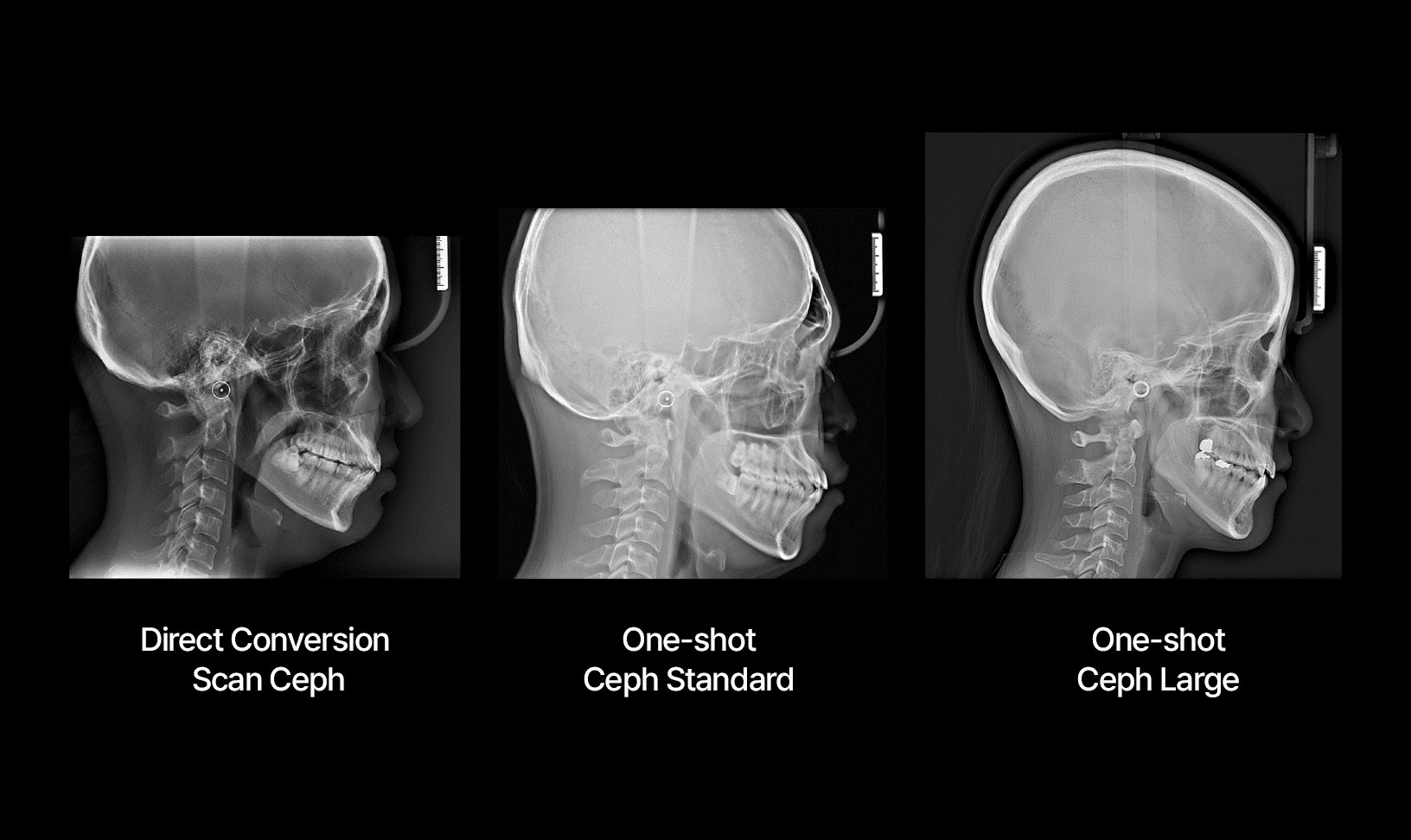 RAY - The Future of Face-Driven Dentistry