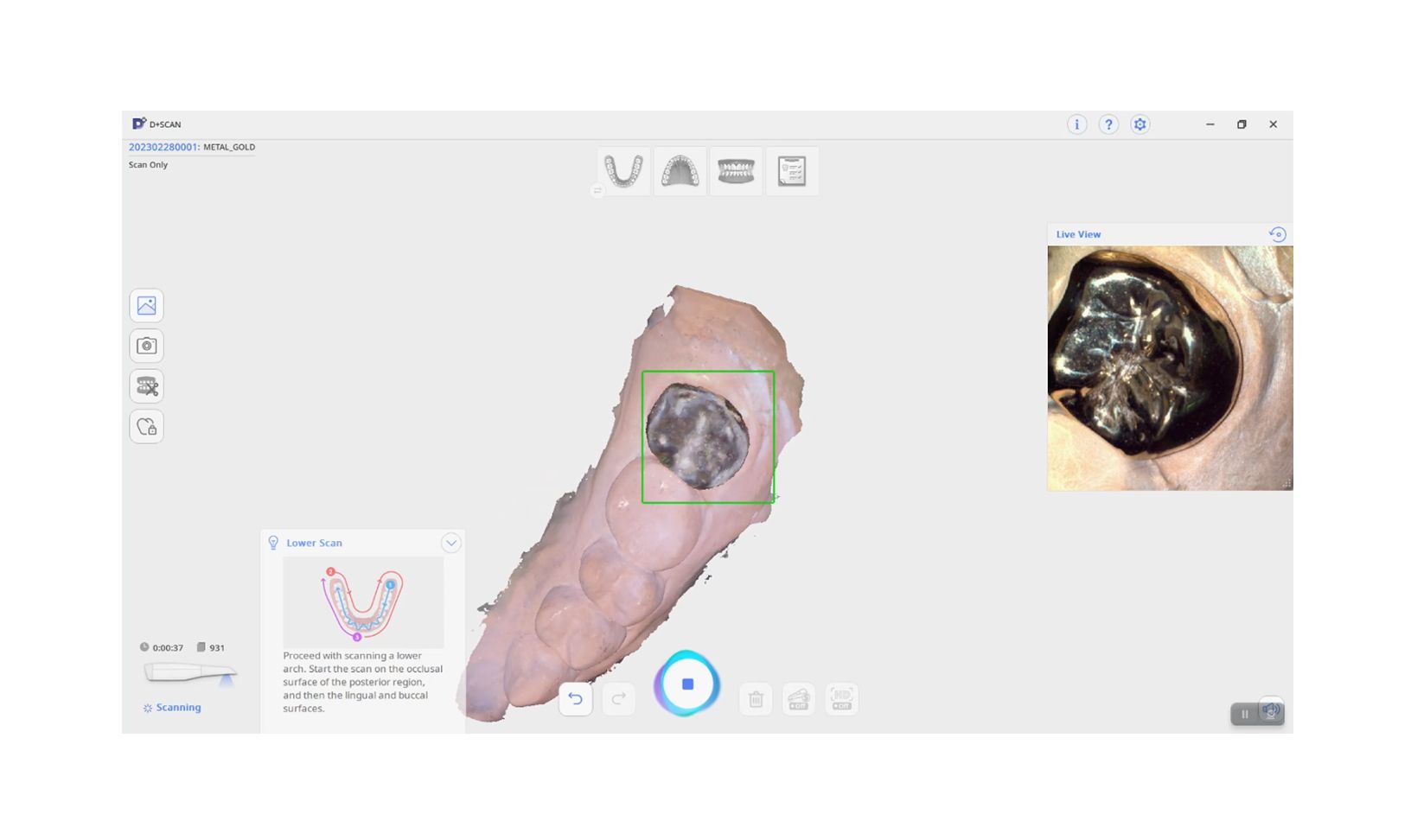 RAY - The Future of Face-Driven Dentistry