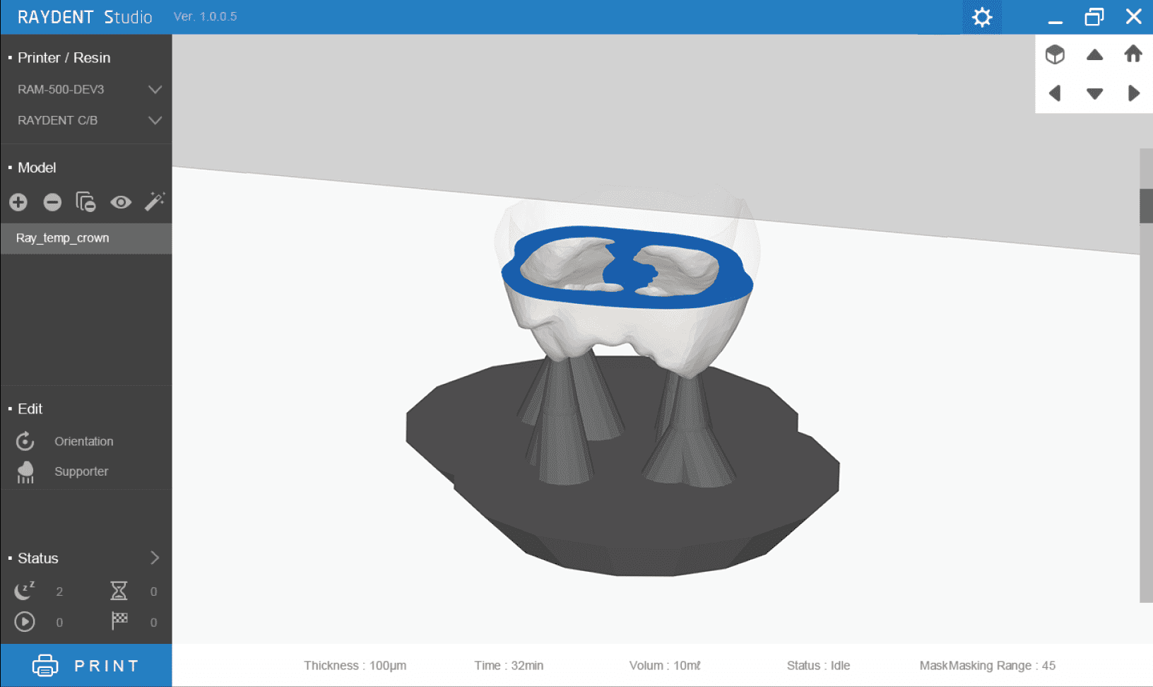 RAY - The Future of Face-Driven Dentistry