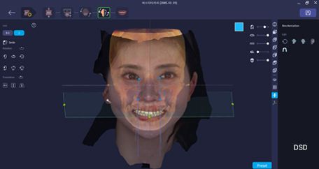 RAY - The Future of Face-Driven Dentistry