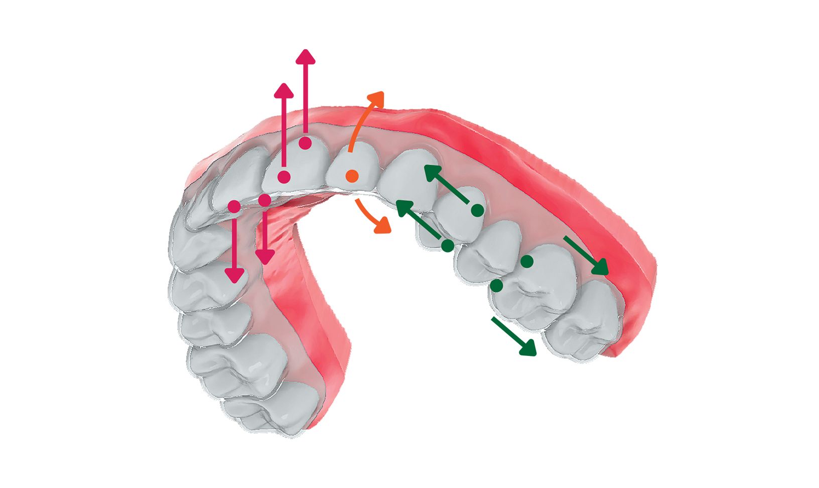 RAY - The Future of Face-Driven Dentistry