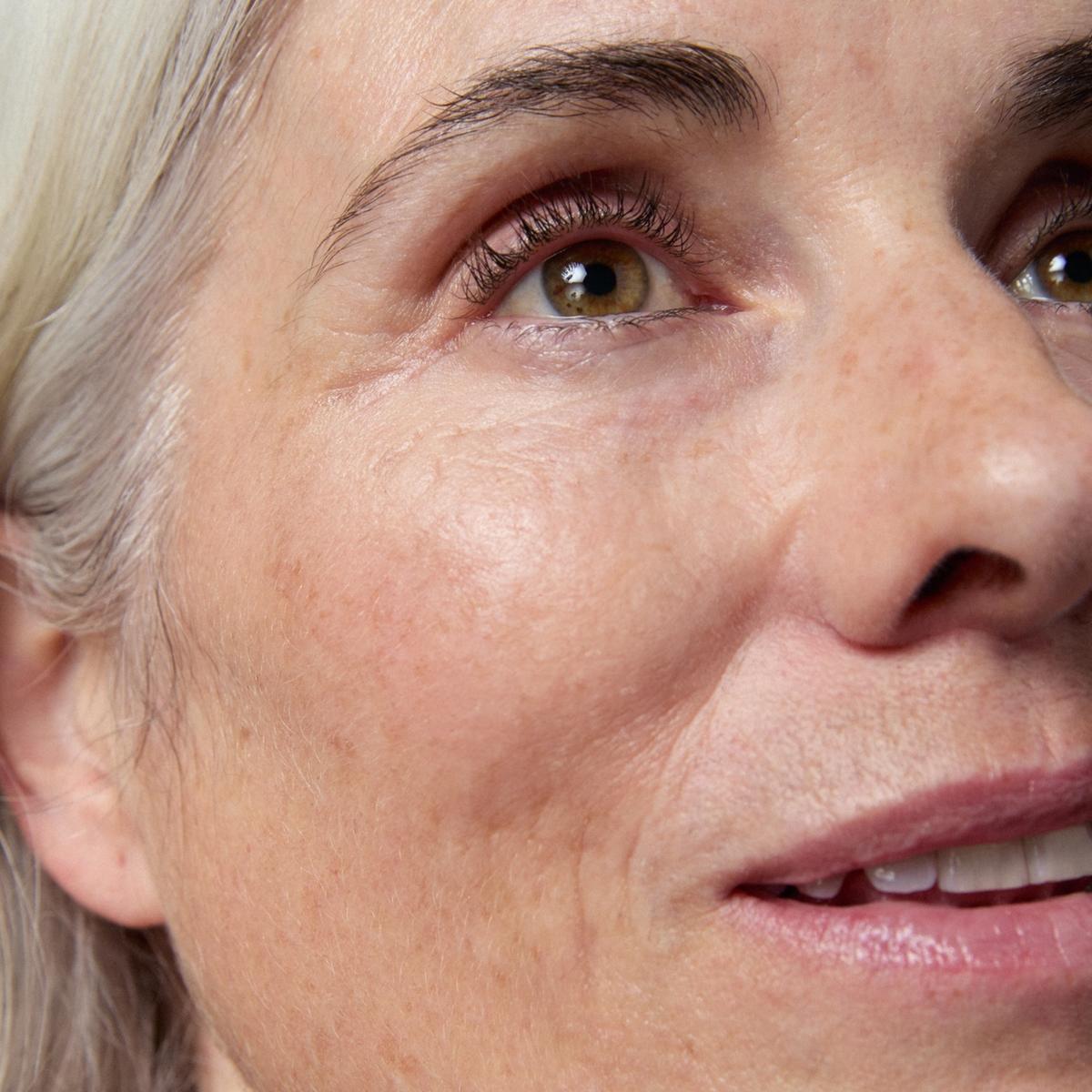 Understanding and Managing Menopause Skin Changes - Timeline