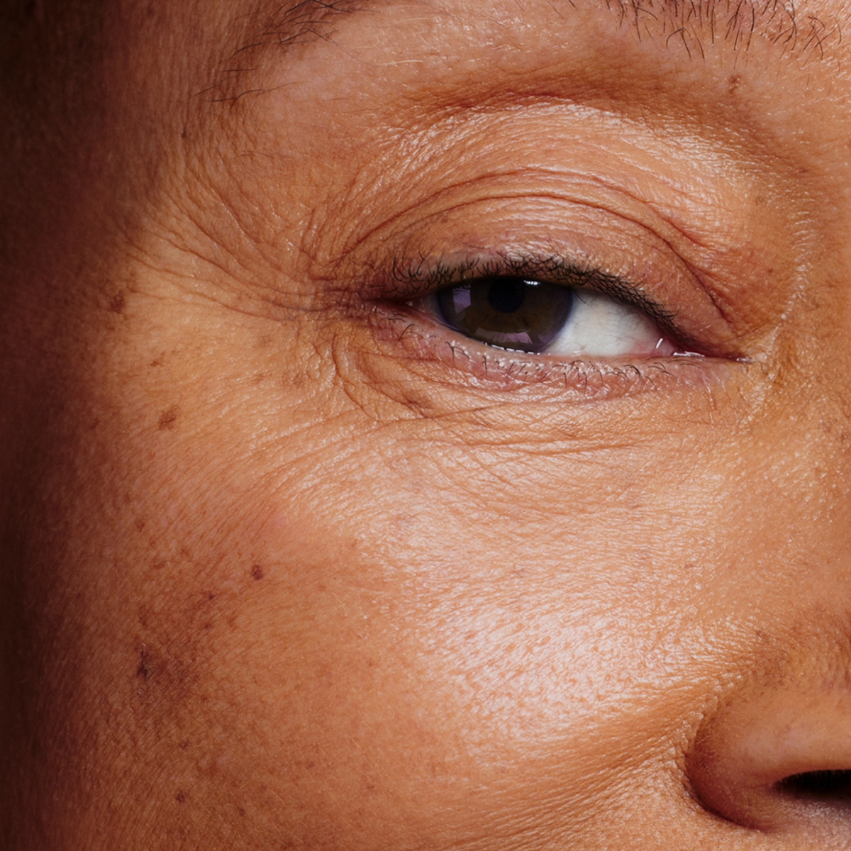 What happens when skin ages? - Timeline