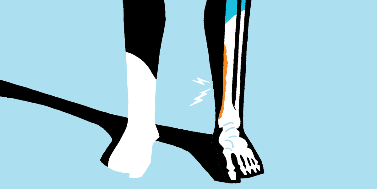 DE VANLIGSTE BELASTNINGSSKADENE - LÖPLABBET MAGASIN