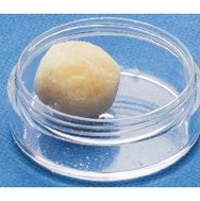 Faster Recovery | Top Orthopedic Surgeon | San Francisco