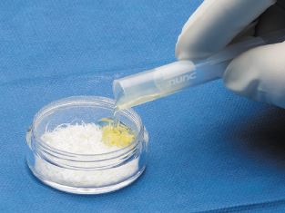 Faster Recovery | Top Orthopedic Surgeon | San Francisco