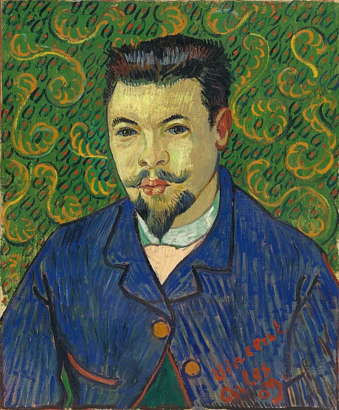 Did Van Gogh cut off his whole ear? Or only a part?