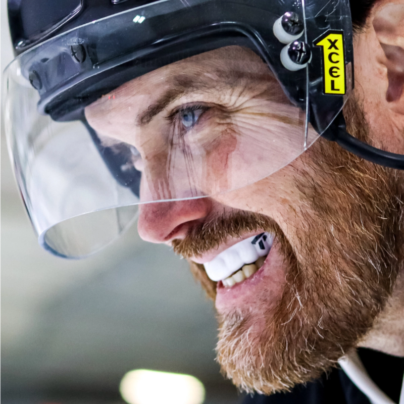 Custom Fit retainers – TruFIT Customs