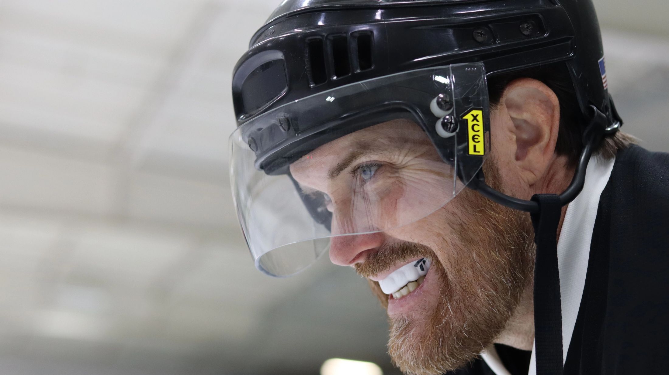 Custom Fit retainers – TruFIT Customs