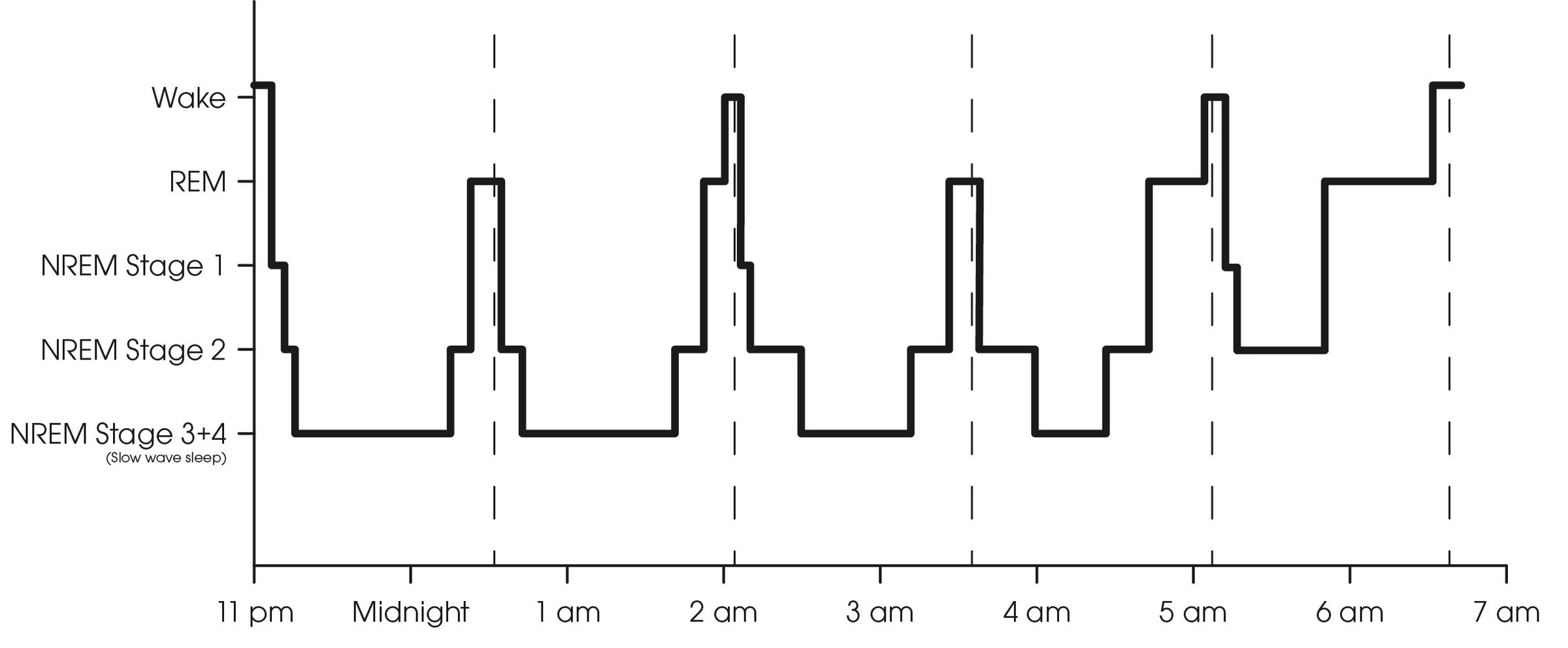 Die Schlafphasen: Welche gibt es und was bedeutet REM?