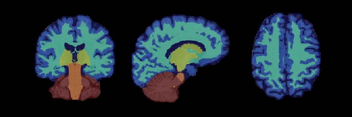 QMENTA Imaging Biomarker Analysis Catalog