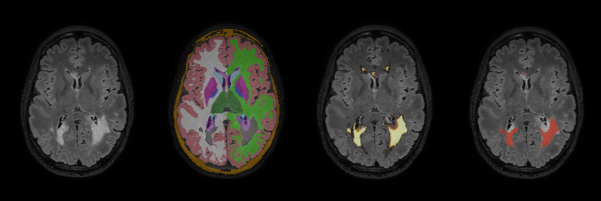 Qmenta Imaging Biomarker Analysis Catalog