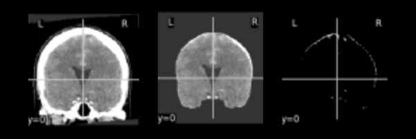 QMENTA Imaging Biomarker Analysis Catalog