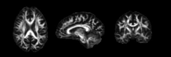 QMENTA Imaging Biomarker Analysis Catalog