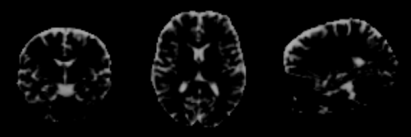 QMENTA Imaging Biomarker Analysis Catalog