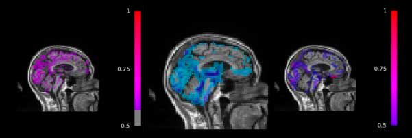 QMENTA Imaging Biomarker Analysis Catalog