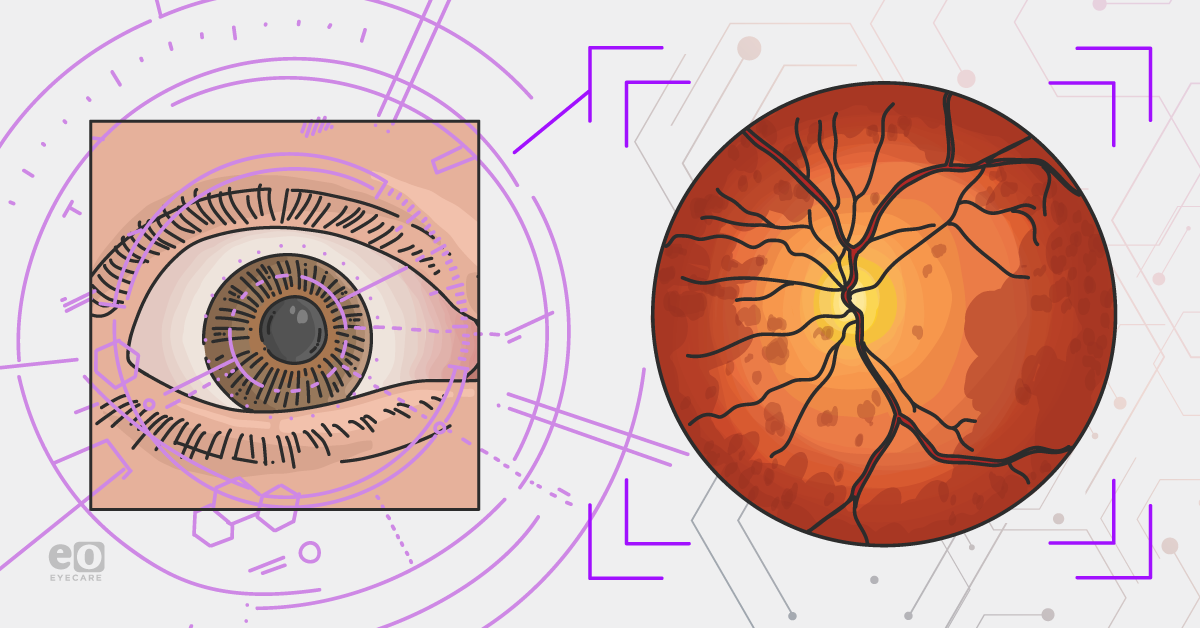 The Impact of AI on Retina: Are You Ready? | Overview